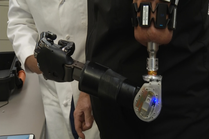 Healthy Living: Bionic Arm – 910News.com