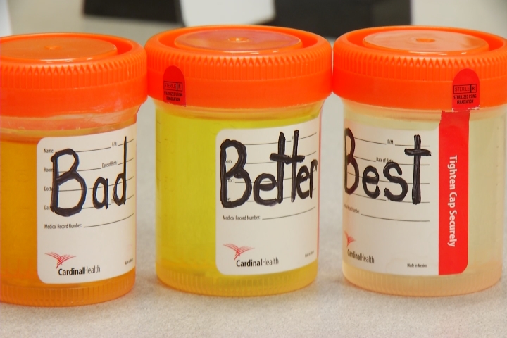 Urine Color A Clear Indication Of Hydration Level – 9and10News.com