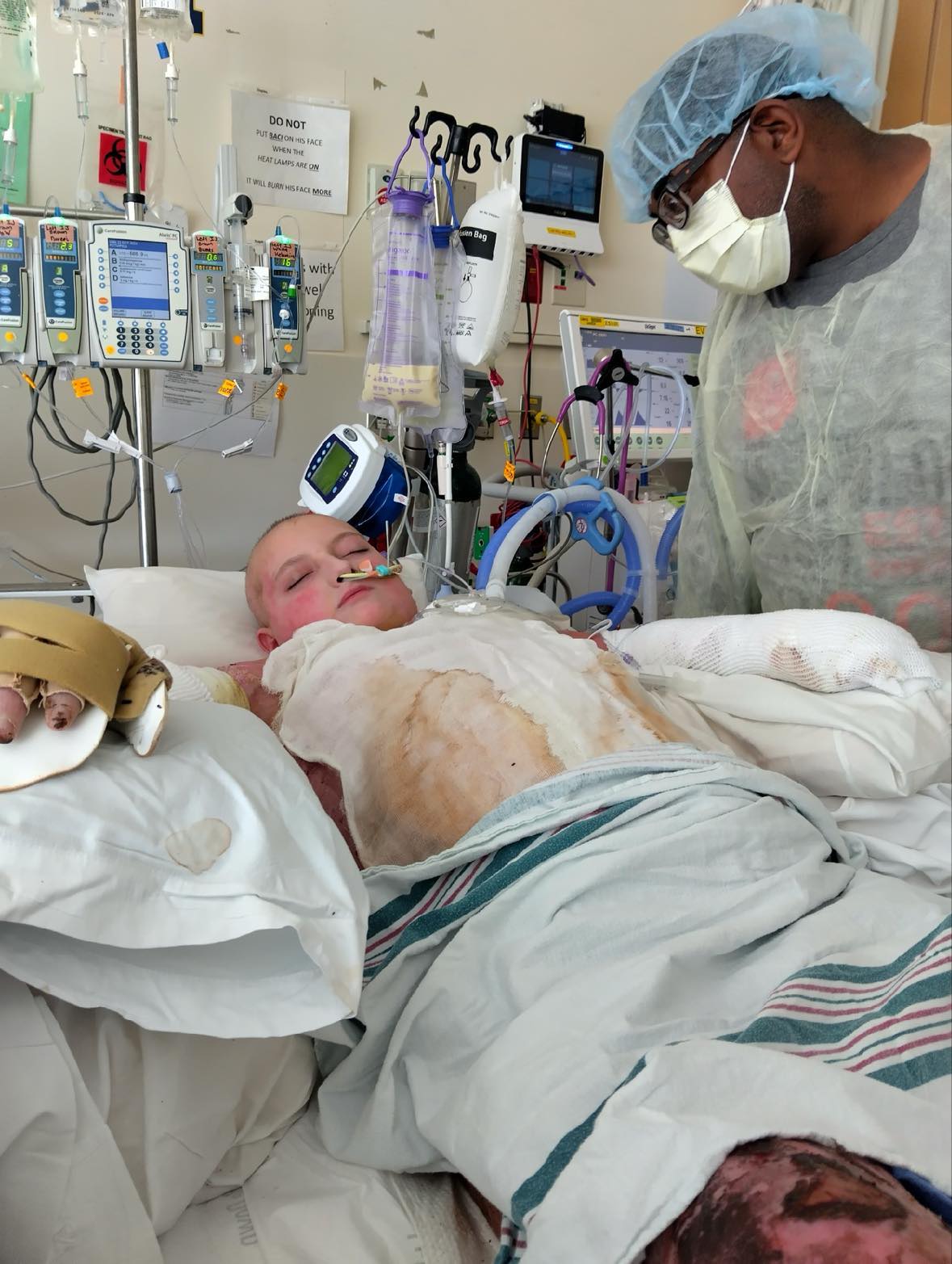 Teen boy recovering months after Saginaw gas can explosion - mlive.com
