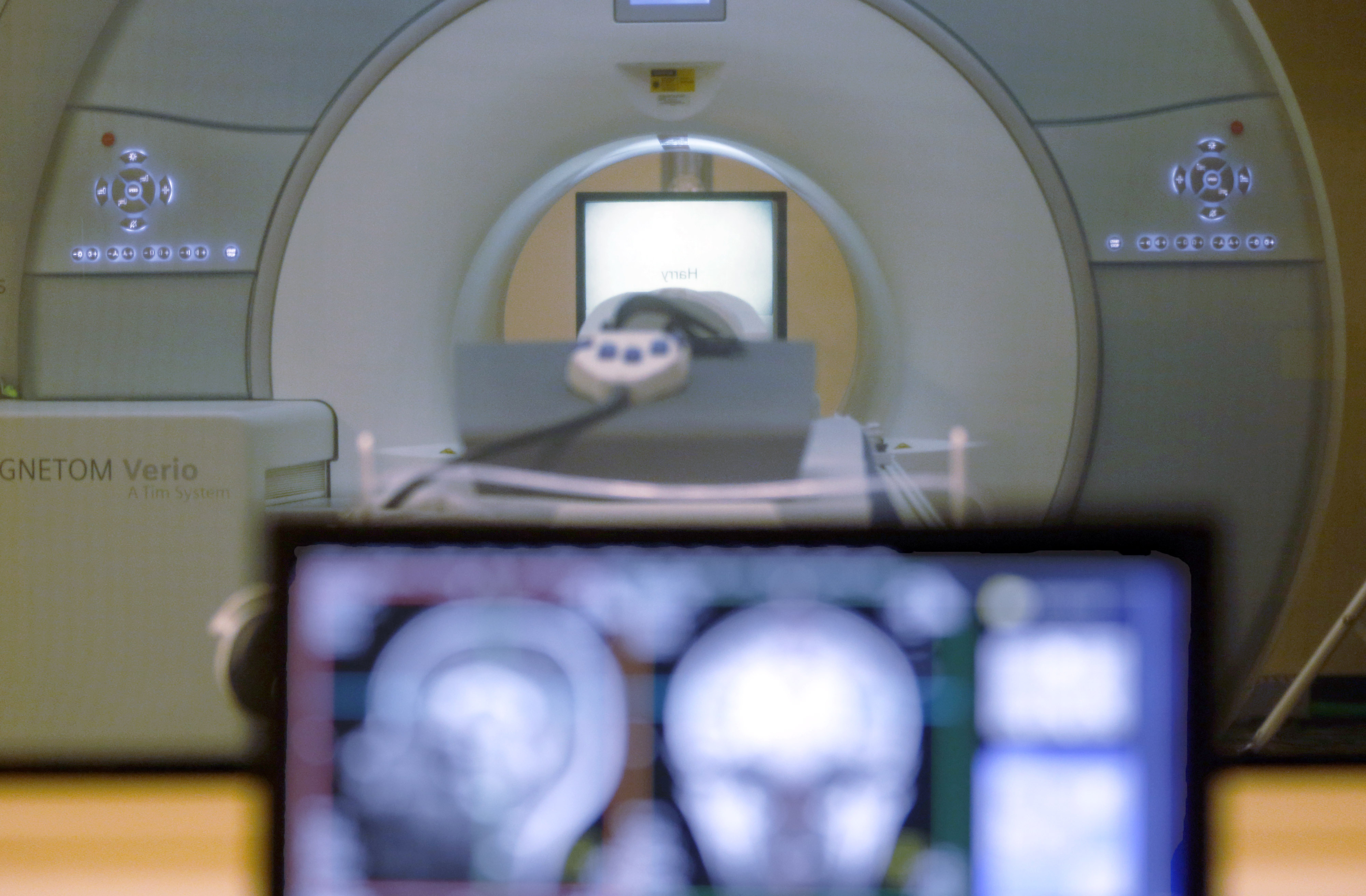 Mri Scan Results How Long