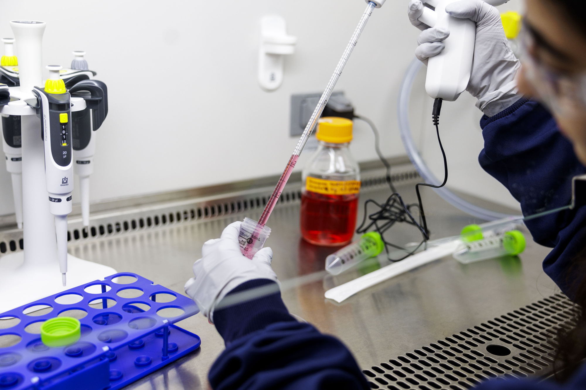 University of Michigan laboratory researches implantable diagnostic ...