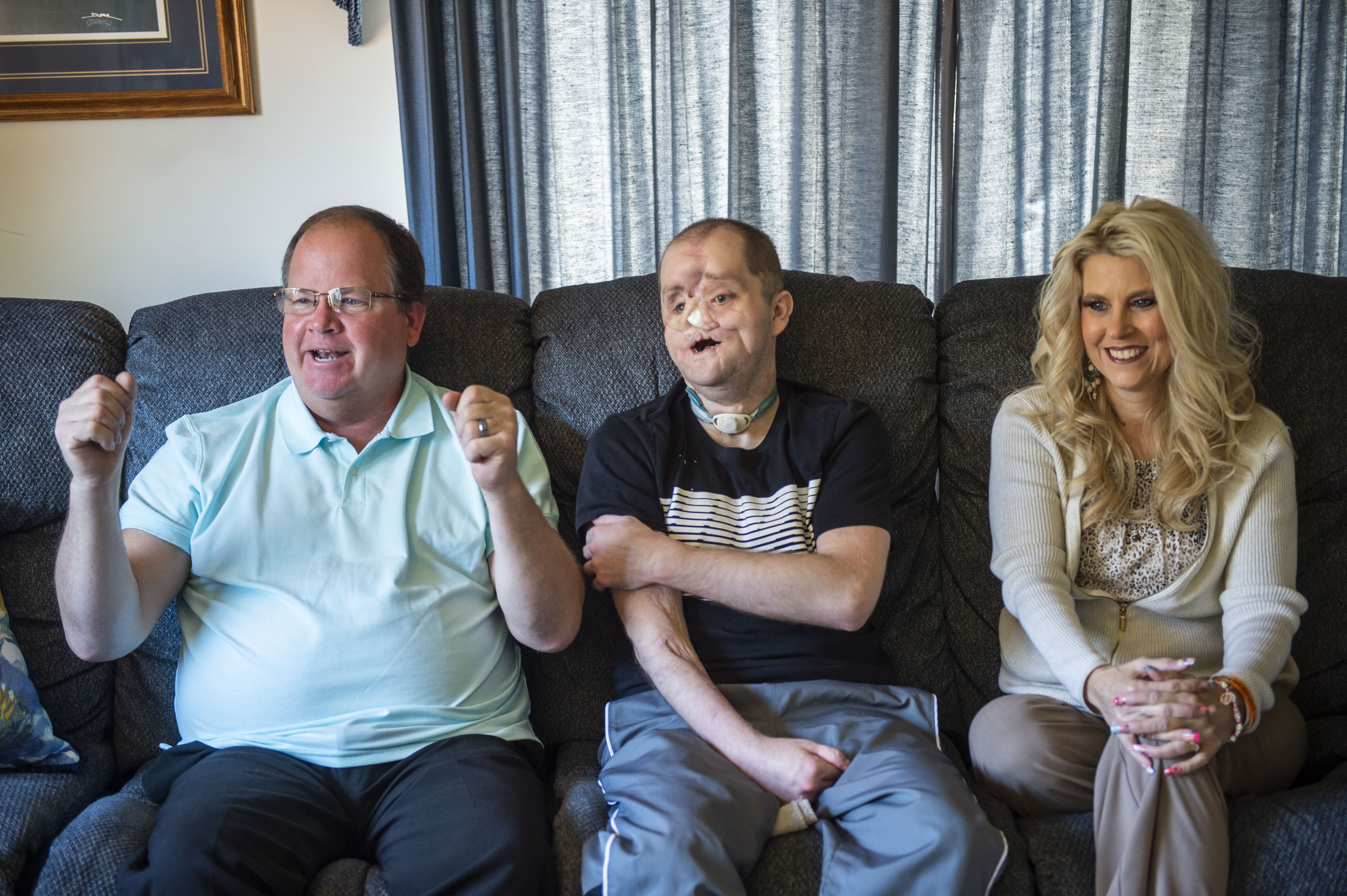Derek Pfaff of Michigan shares his story as he seeks face transplant ...