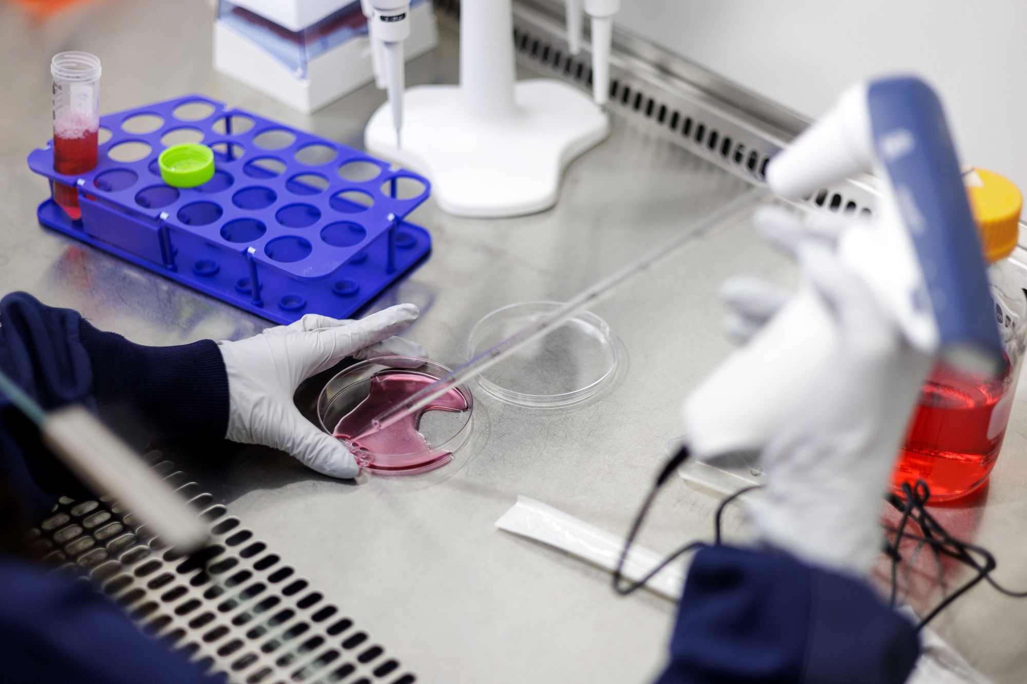 University of Michigan laboratory researches implantable diagnostic ...