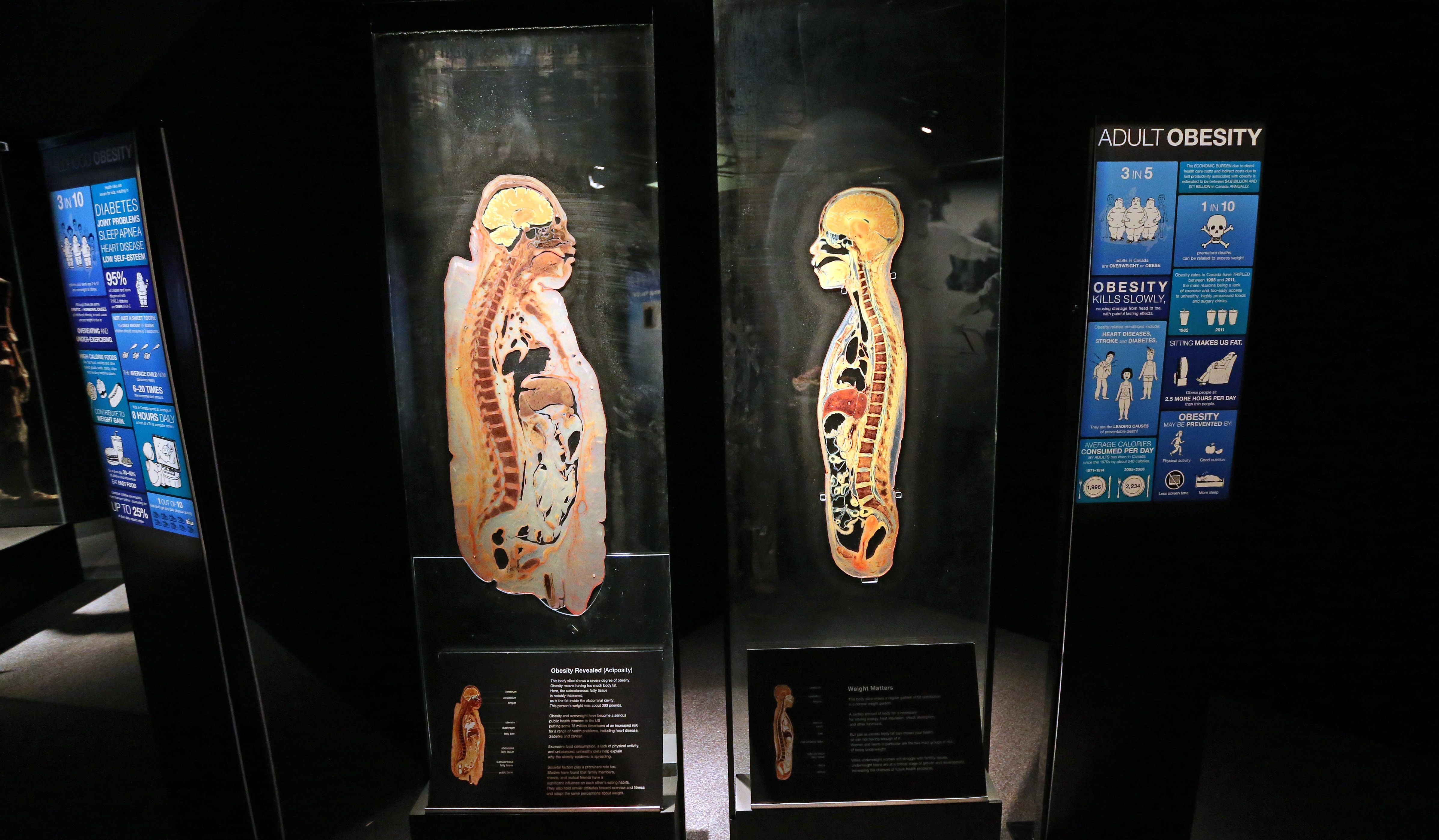 BODY WORLDS Rx set to open at Great Lakes Science Center, June 3, 2020 ...