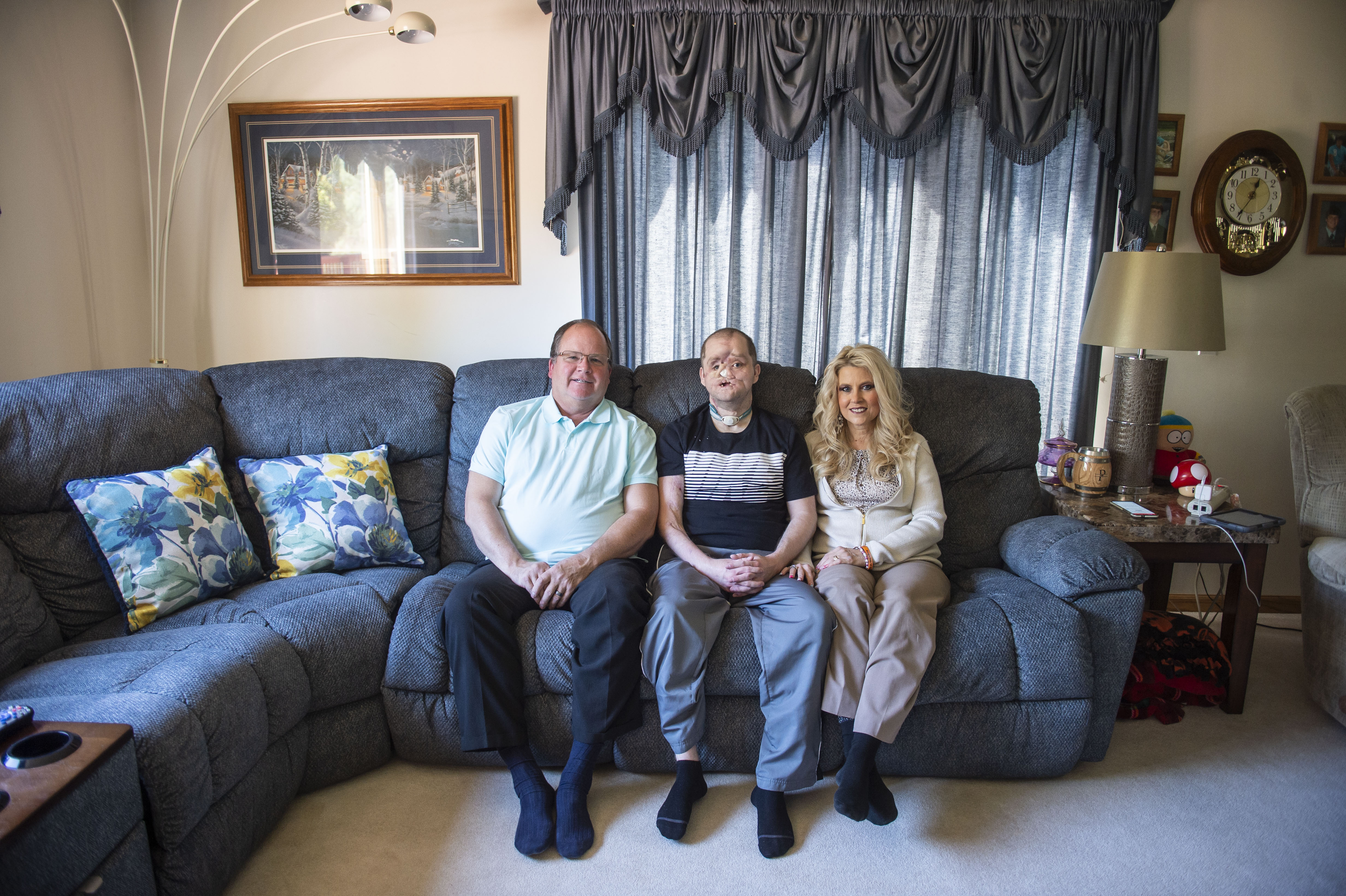 Derek Pfaff of Michigan shares his story as he seeks face transplant ...