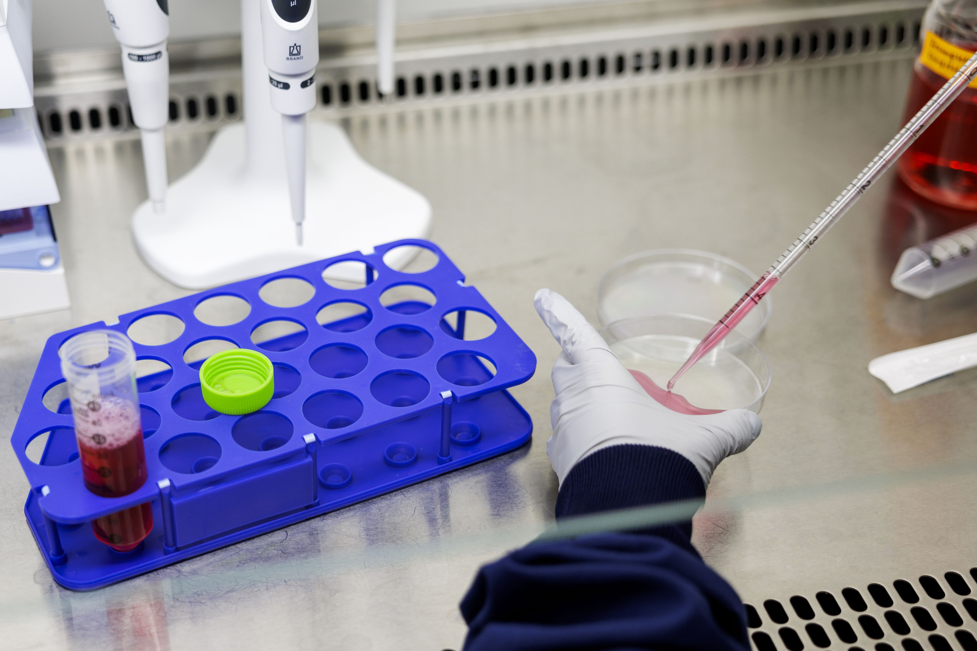 University of Michigan laboratory researches implantable diagnostic ...