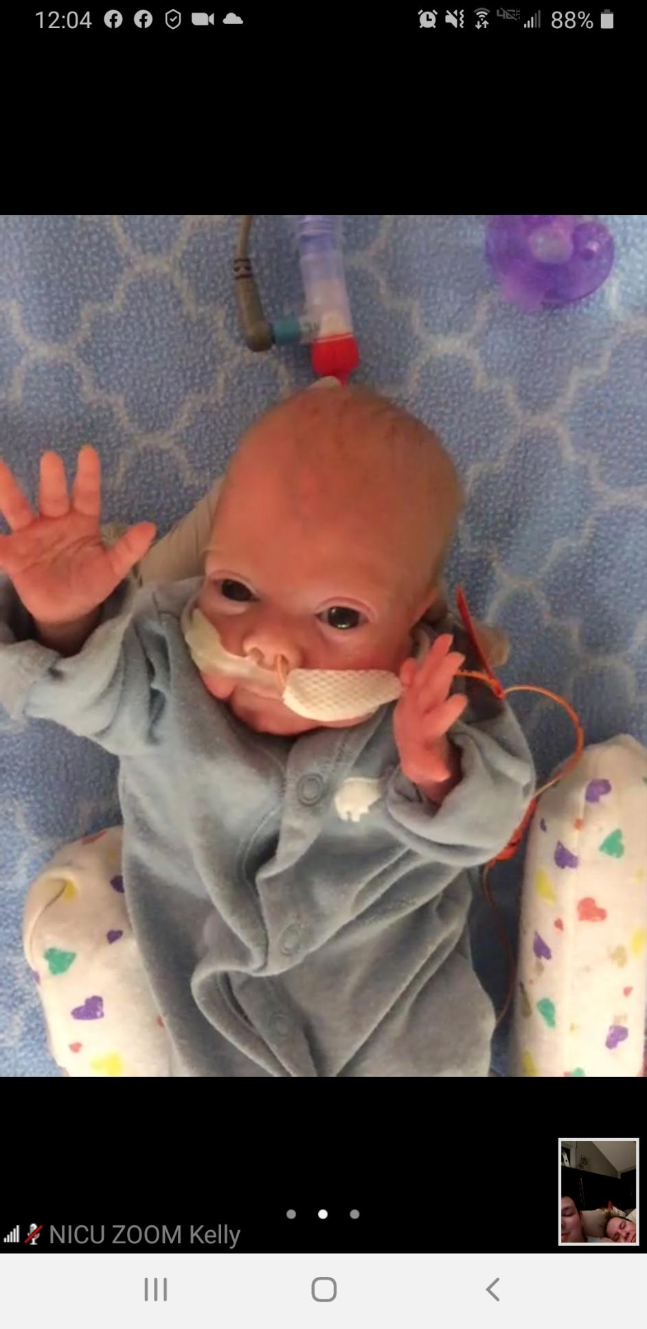 Caldera parents visit baby in NICU - syracuse.com