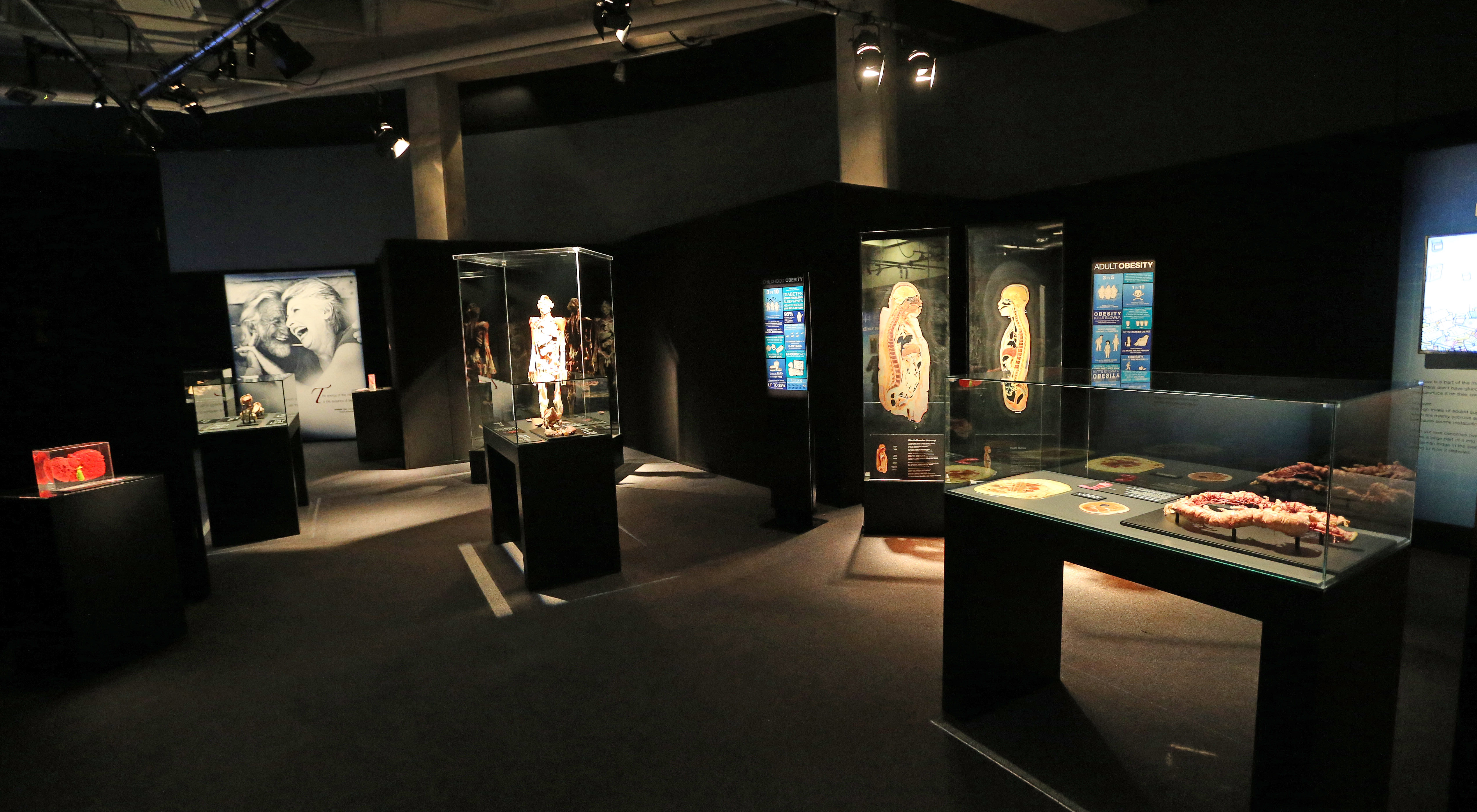 BODY WORLDS Rx set to open at Great Lakes Science Center, June 3, 2020 ...