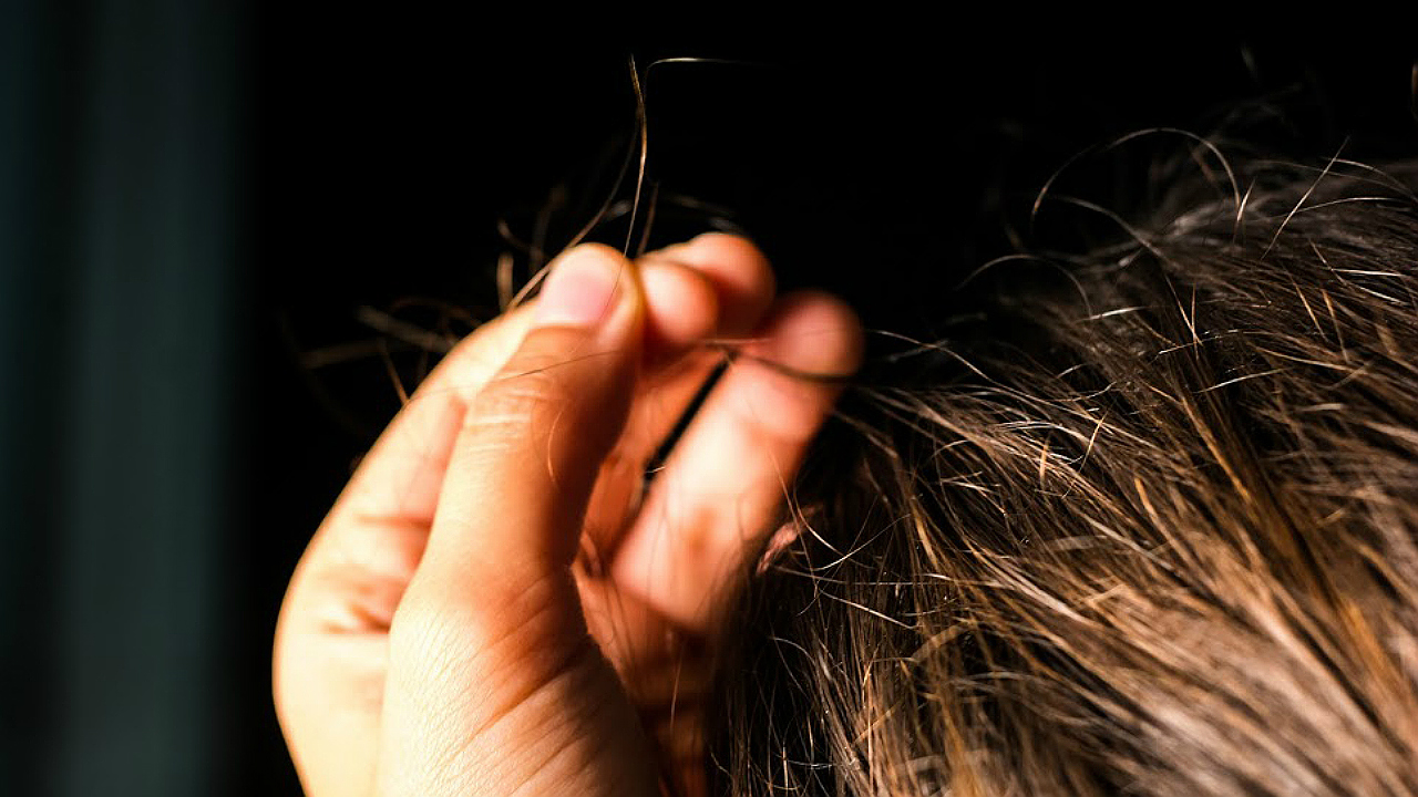 Arrancarme El Pelo En El Trabajo