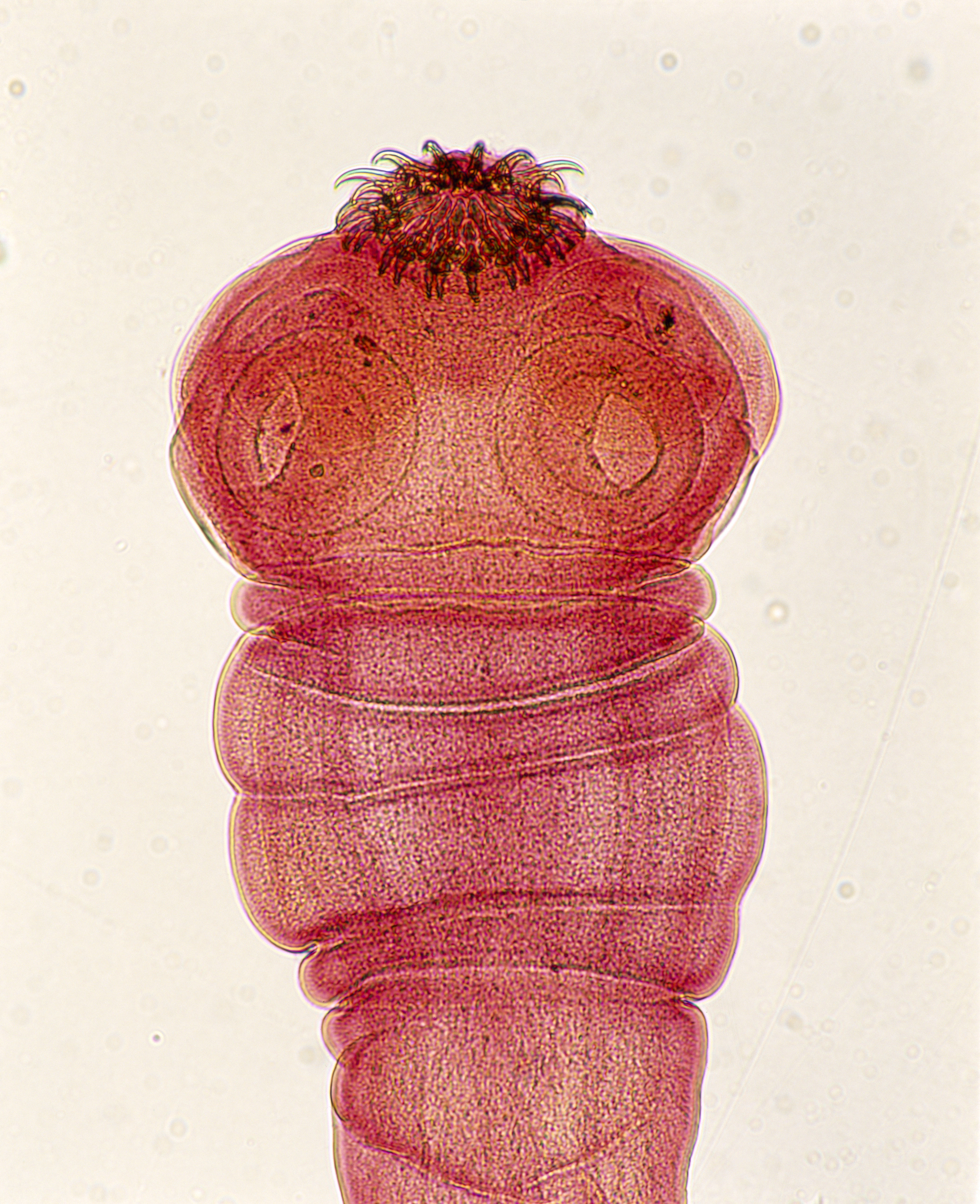 Taenia Tapeworm Scientific Name