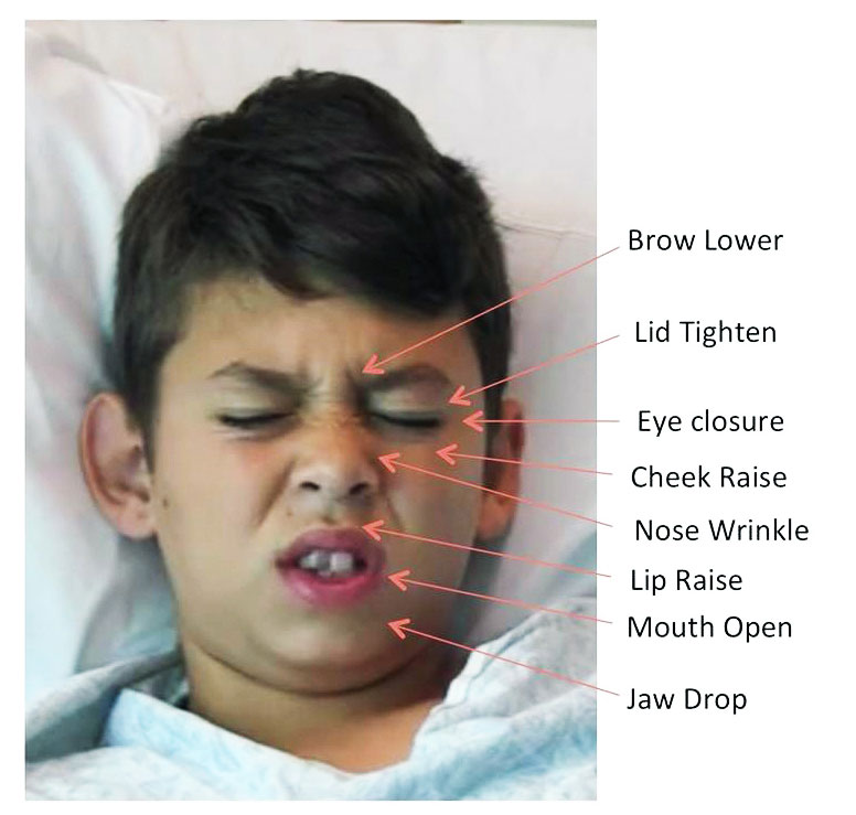 Innovations: Facial recognition software measures pain - Modern Healthcare