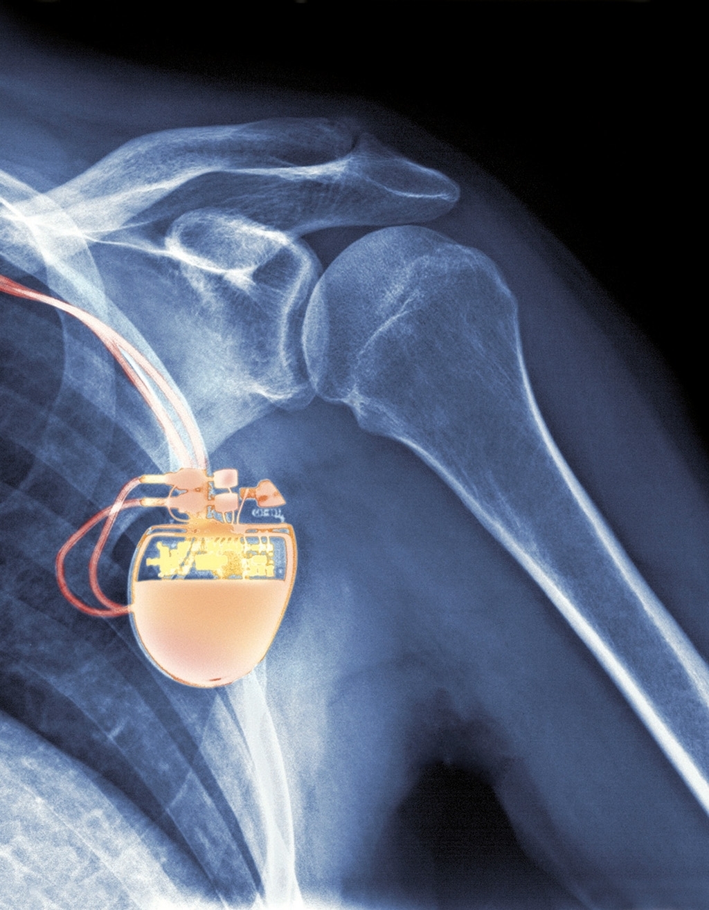 How DOJ got 500-plus hospitals to settle over cardiac implants - Modern ...