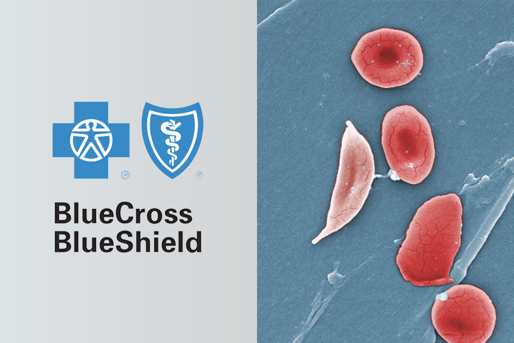 Sickle cell gene therapy to be covered by Blue Cross insurers - Modern ...