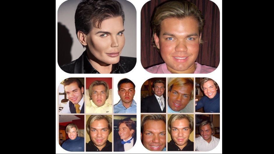 Instagram: ¡Increíble! Quiere parecerse a 'Ken' y ha gastado más de 400 ...