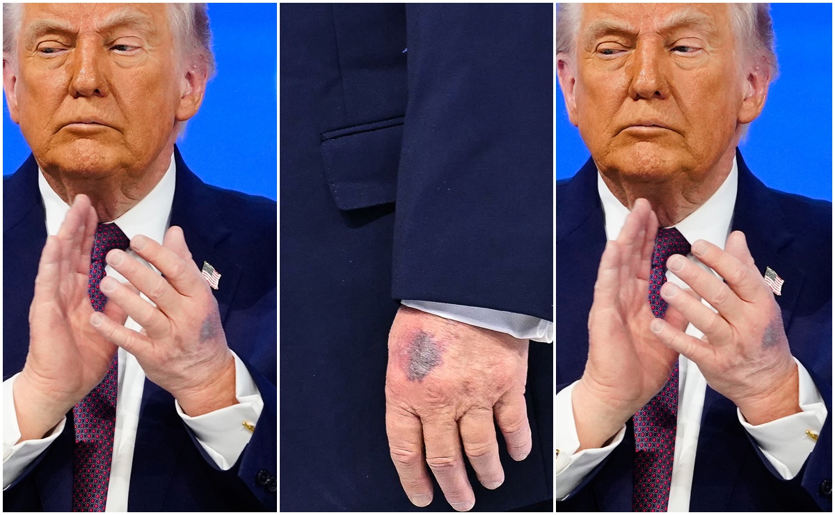 EU sale de la OMS: Trump oficializa retirada y genera alerta global ...