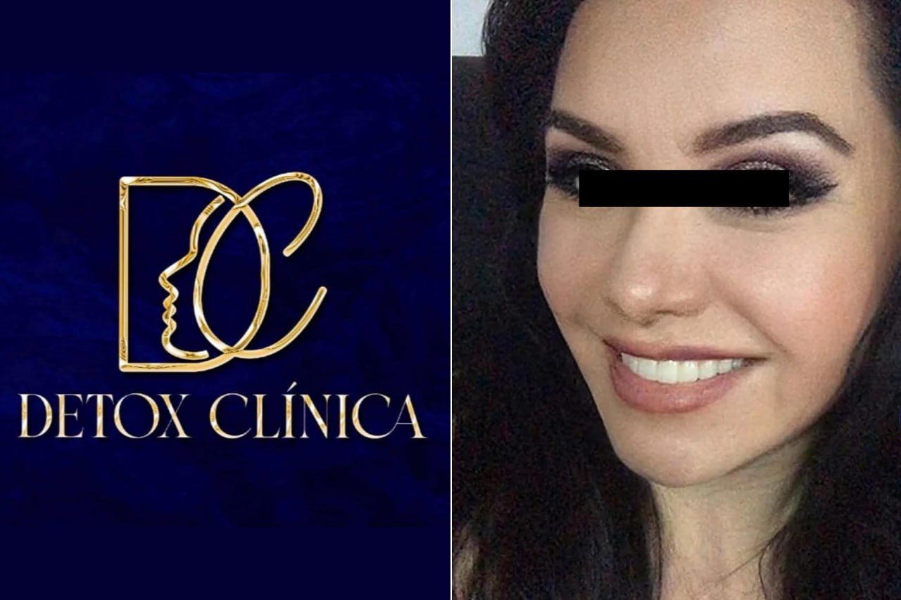 ¿Qué riesgos tiene una liposucción? Lo que debes saber antes de entrar ...