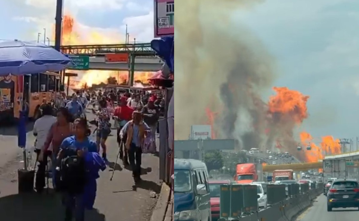 Explosión de Pipa en Puente La Concordia: Video de declaraciones de heridos