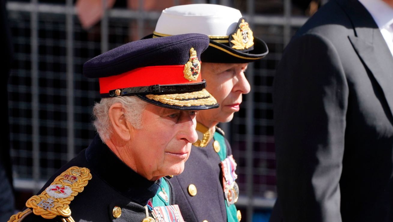 ¿Por qué el rey Carlos III tiene los dedos hinchados?