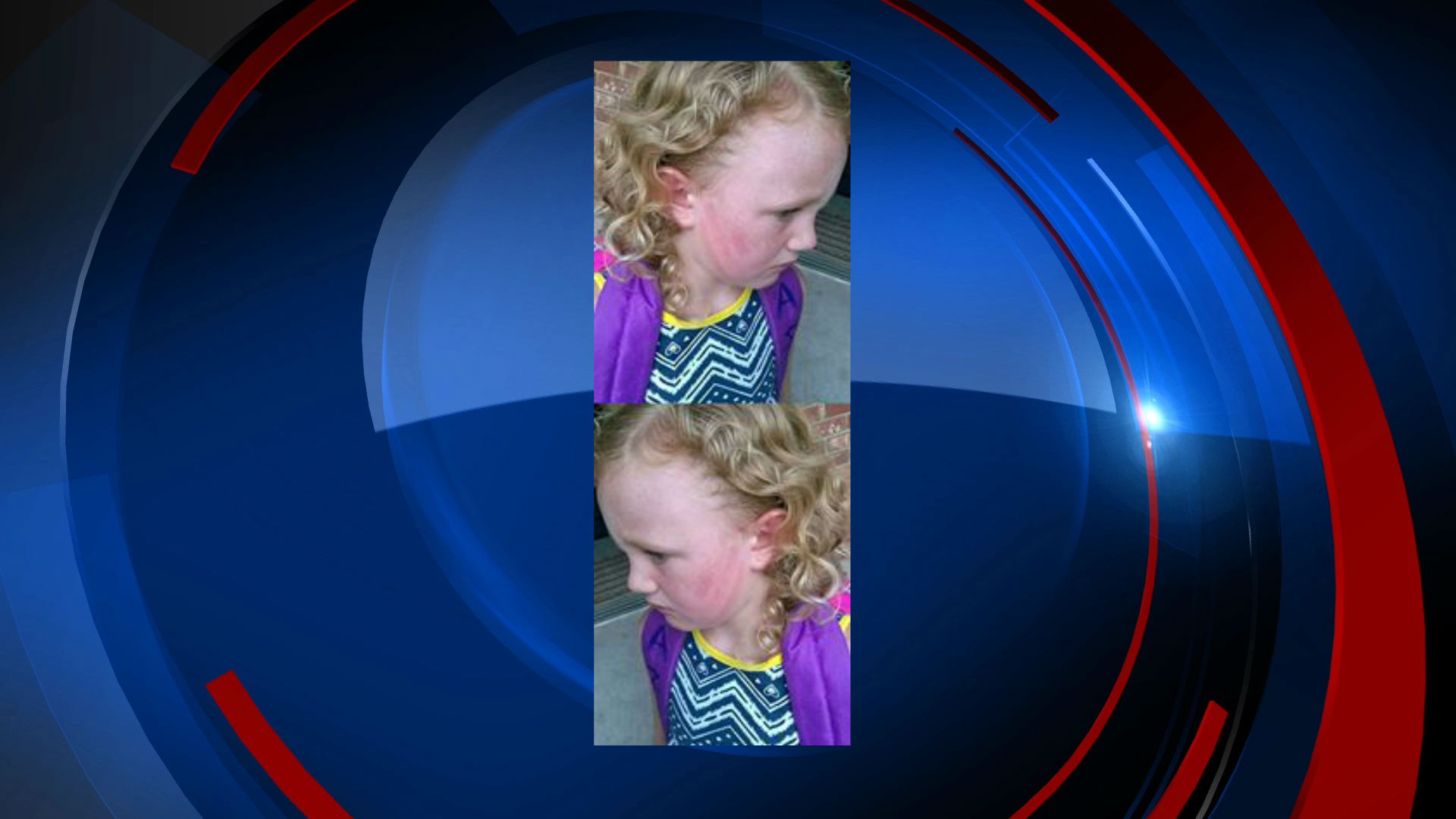 Slap Handprint On Face