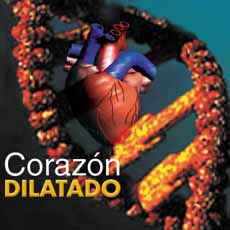 Corazón dilatado | La Nación
