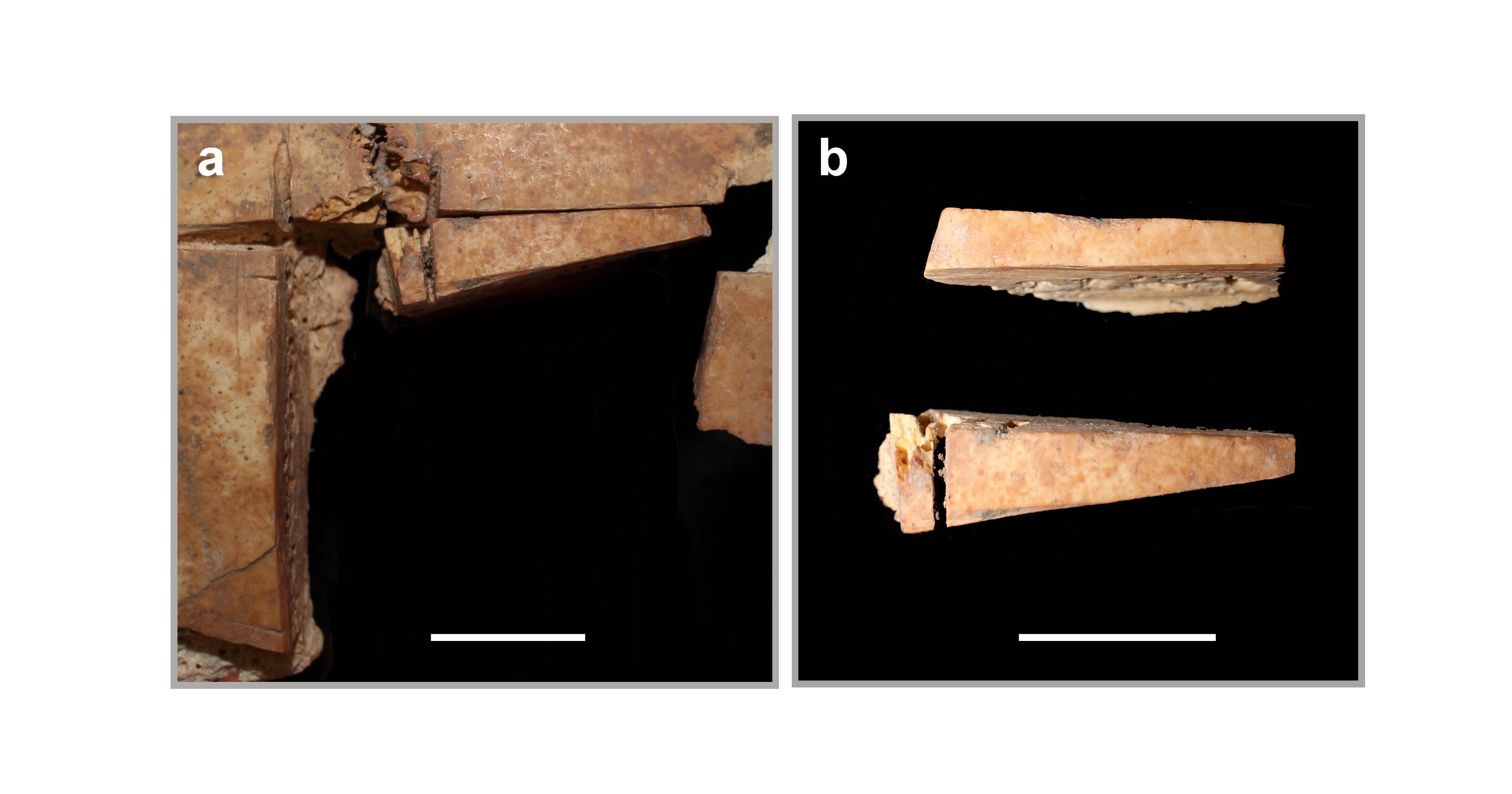 Hace Más De 3500 Años Ya Se Hacían Cirugías Del Cerebro En Medio