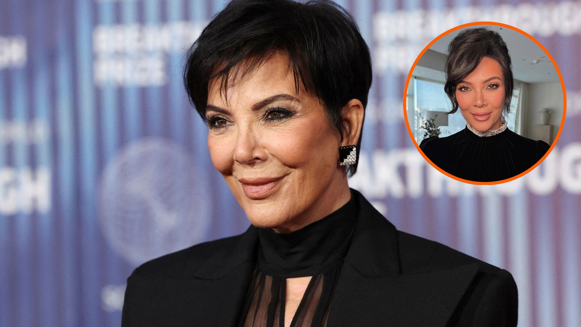 Chris Jenner Cirugia Plastica Susto