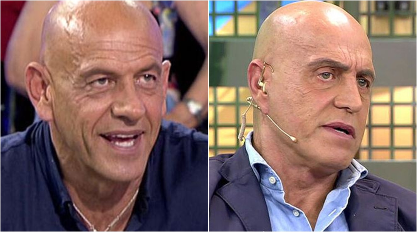 Kiko Matamoros Antes Y Después – GDAY
