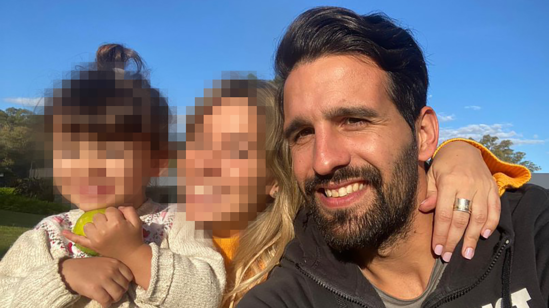 La Impactante Imagen De Las Piernas De Un Futbolista Que Sufrió Un Grave Accidente Doméstico 