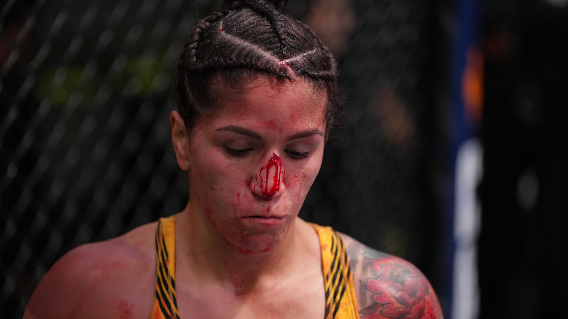 그녀는 두 개의 이빨을 놓치고 Ufc 경기 후 사진이 입소문을 냈습니다 “나는 가장 귀여운 이빨없는 여성입니다 ” Infobae