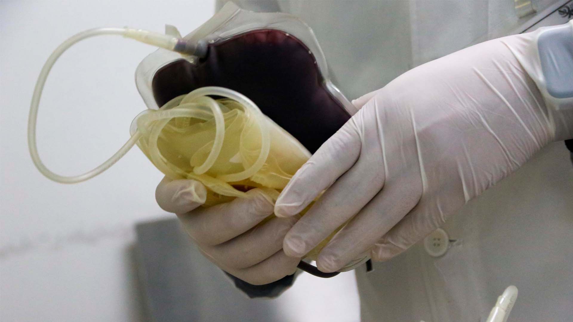 La Fda Planteó Flexibilizar Las Reglas De Donación De Sangre Para 3447