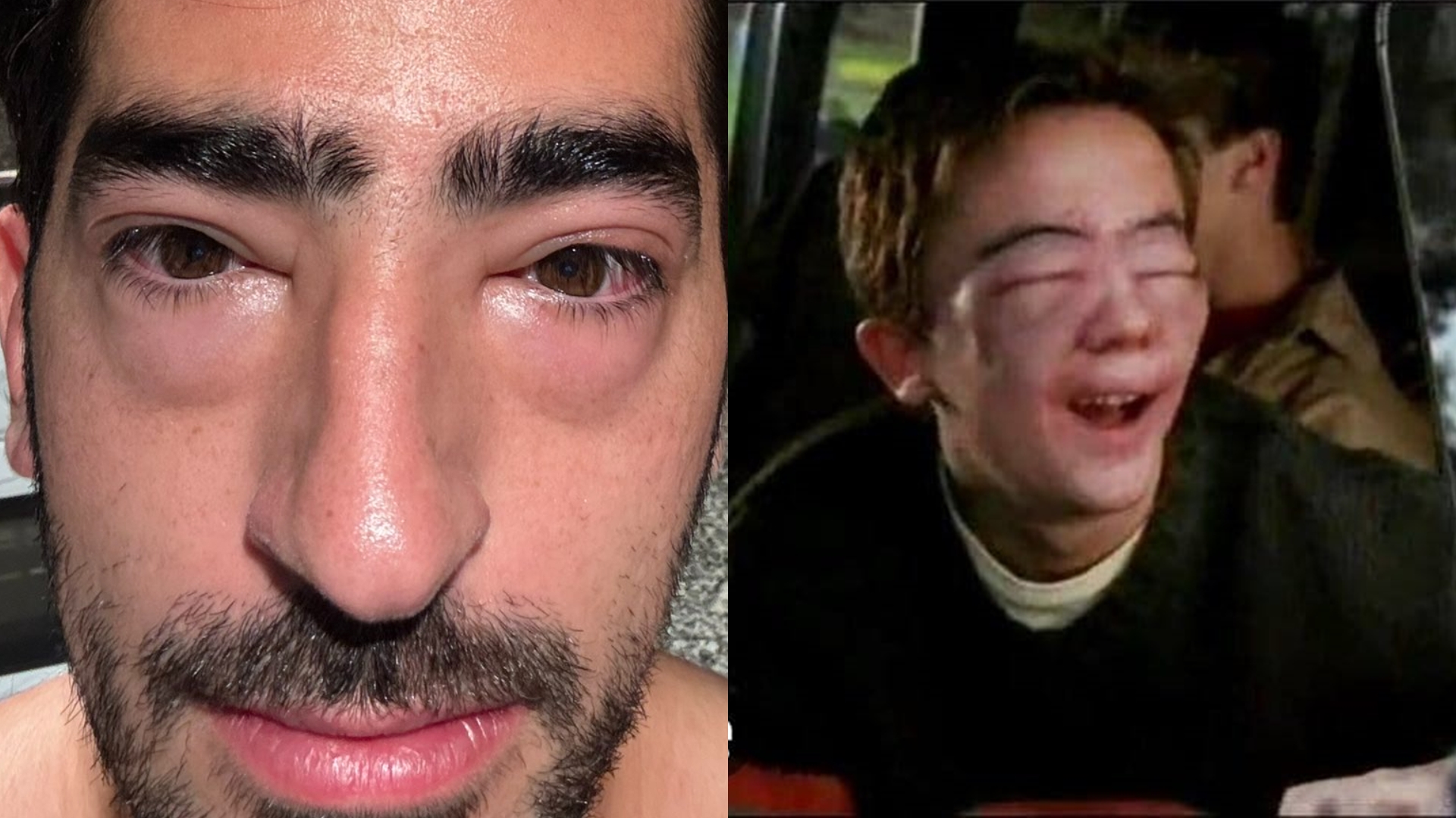 Cara De Meme De Ojos Grandes