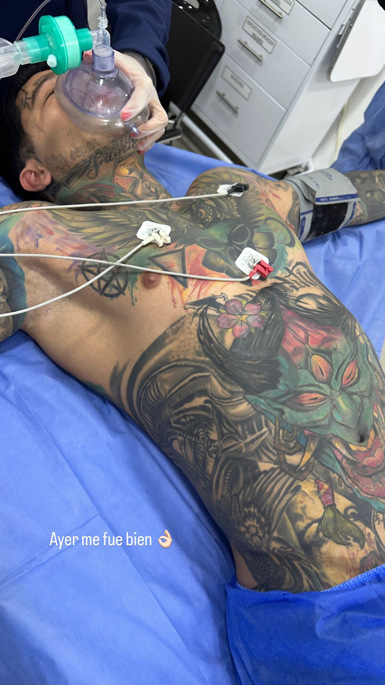 Yeferson Cossio Utilizó Anestesia General Para Nuevo Tatuaje Y Es