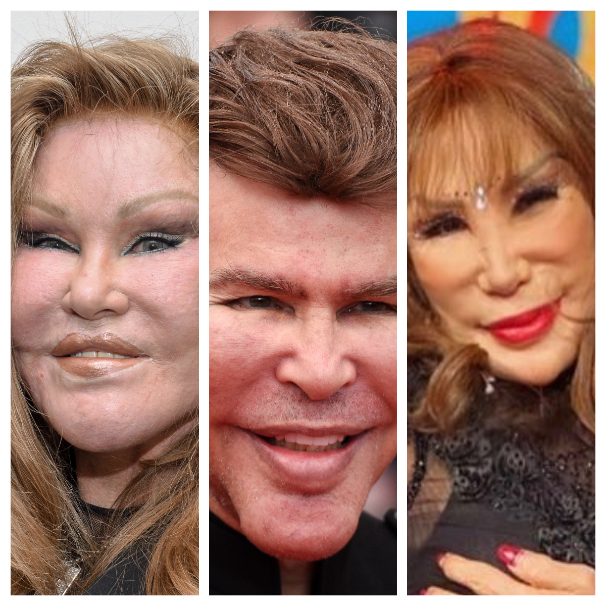 Michaela Romanini Before And After