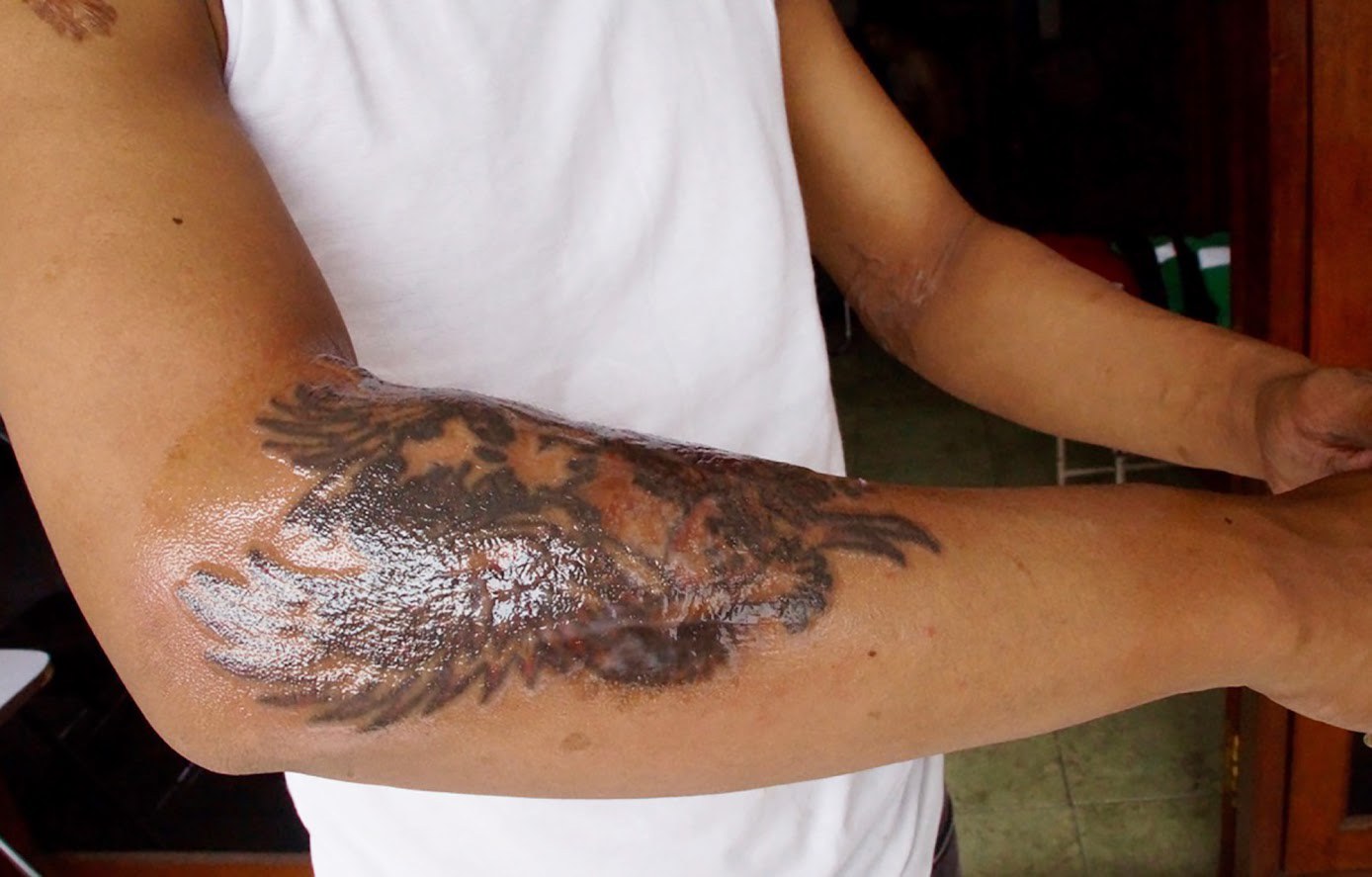 Jasa Hapus Tattoos Panduan Membuat Tato: Pengalaman Dan Tips