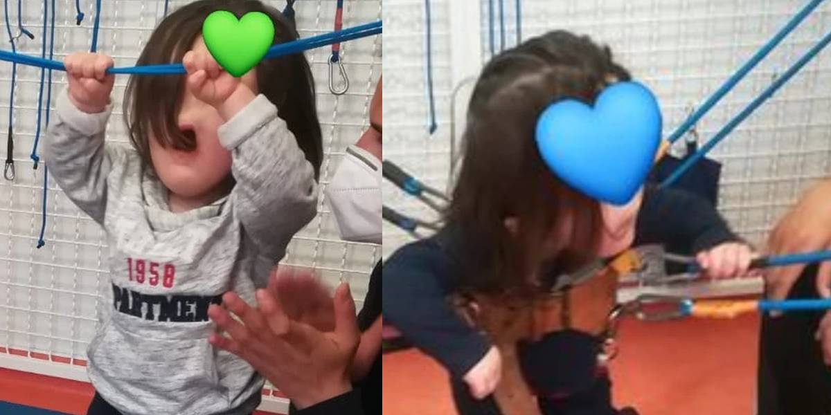 🟡 Nació sin rostro, le dieron pocos días de vida pero ya tiene 2 años y ...