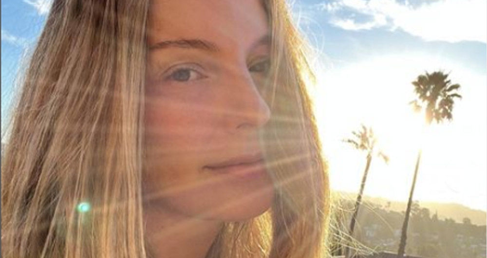 Claudia Bahamón contó cómo se ha sentido desde que se retiró los implantes