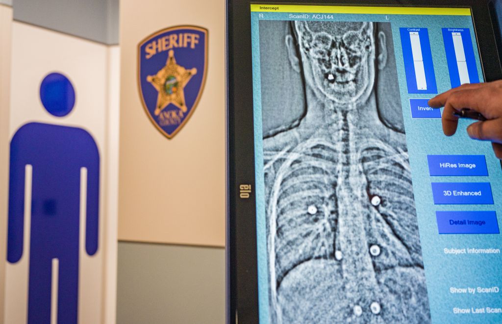 Anoka County turns to $145K body scanner to reverse surge in jail drug ...