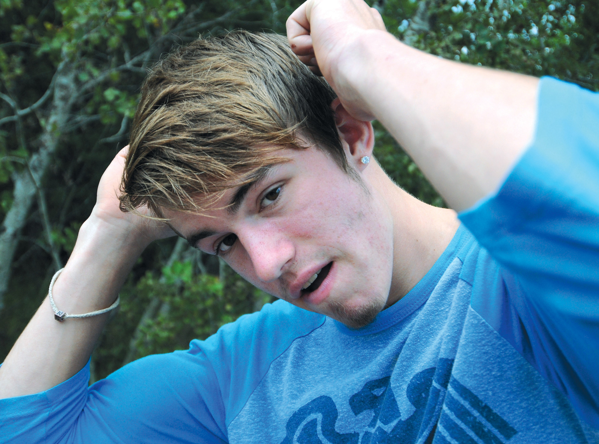 Deformed wolf that bit Minnesota teen had brain damage