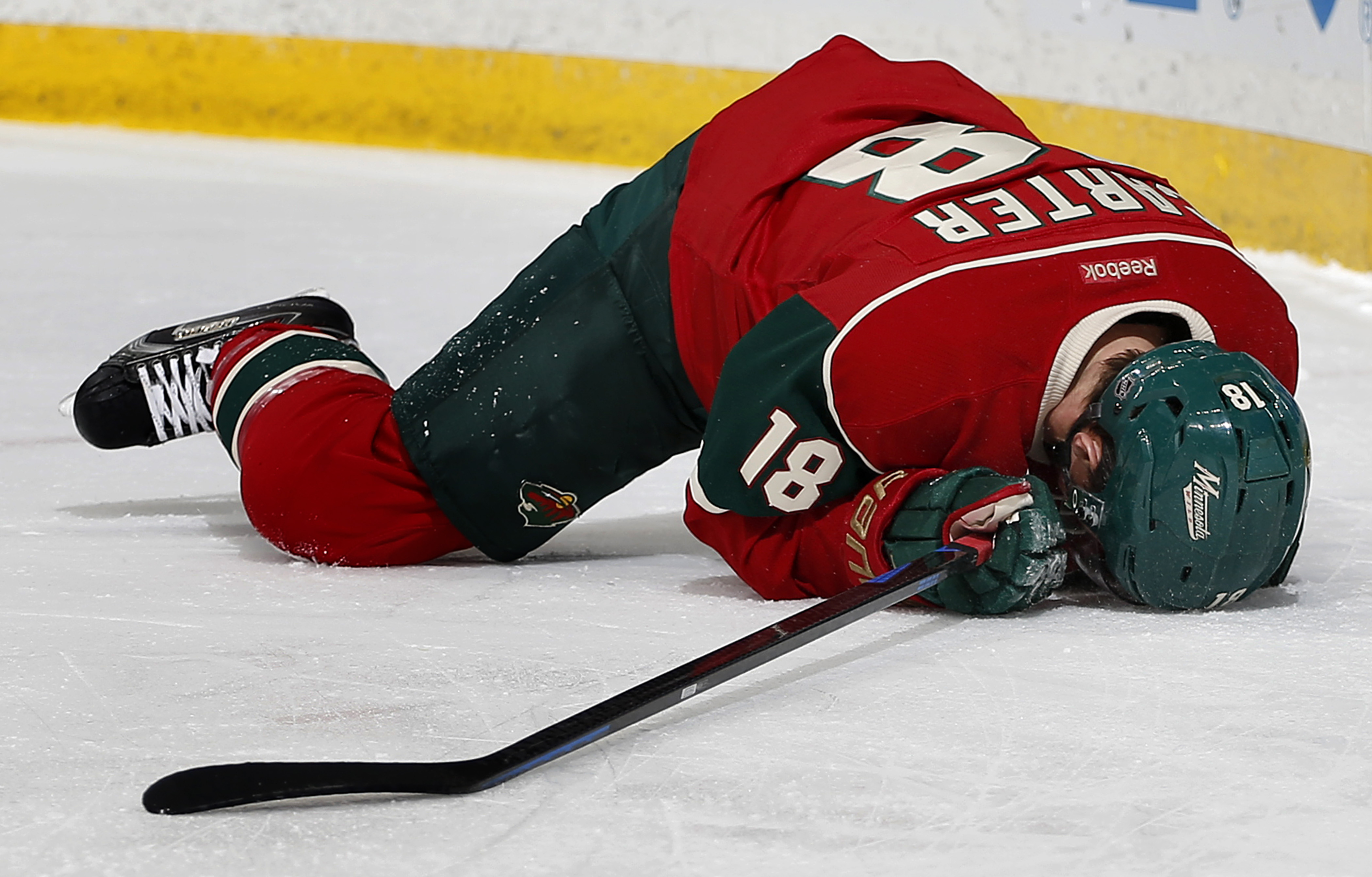 Worst Hockey Injuries