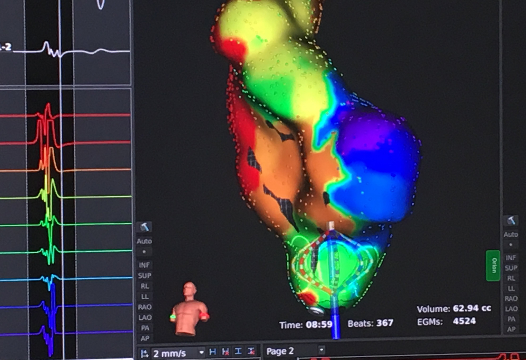Boston Scientific heart-mapping system shows promise in trial