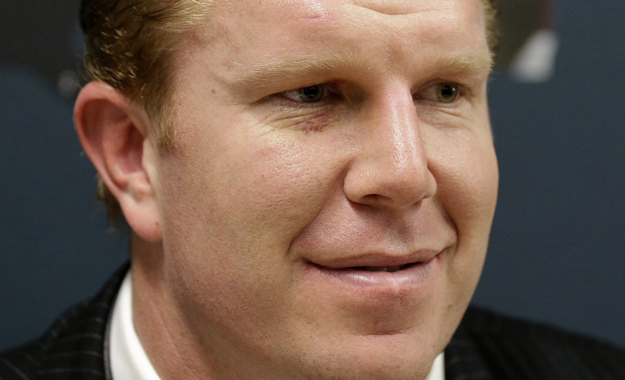 Ex-Viking Matt Birk tweets skepticism about NFL brain injury study