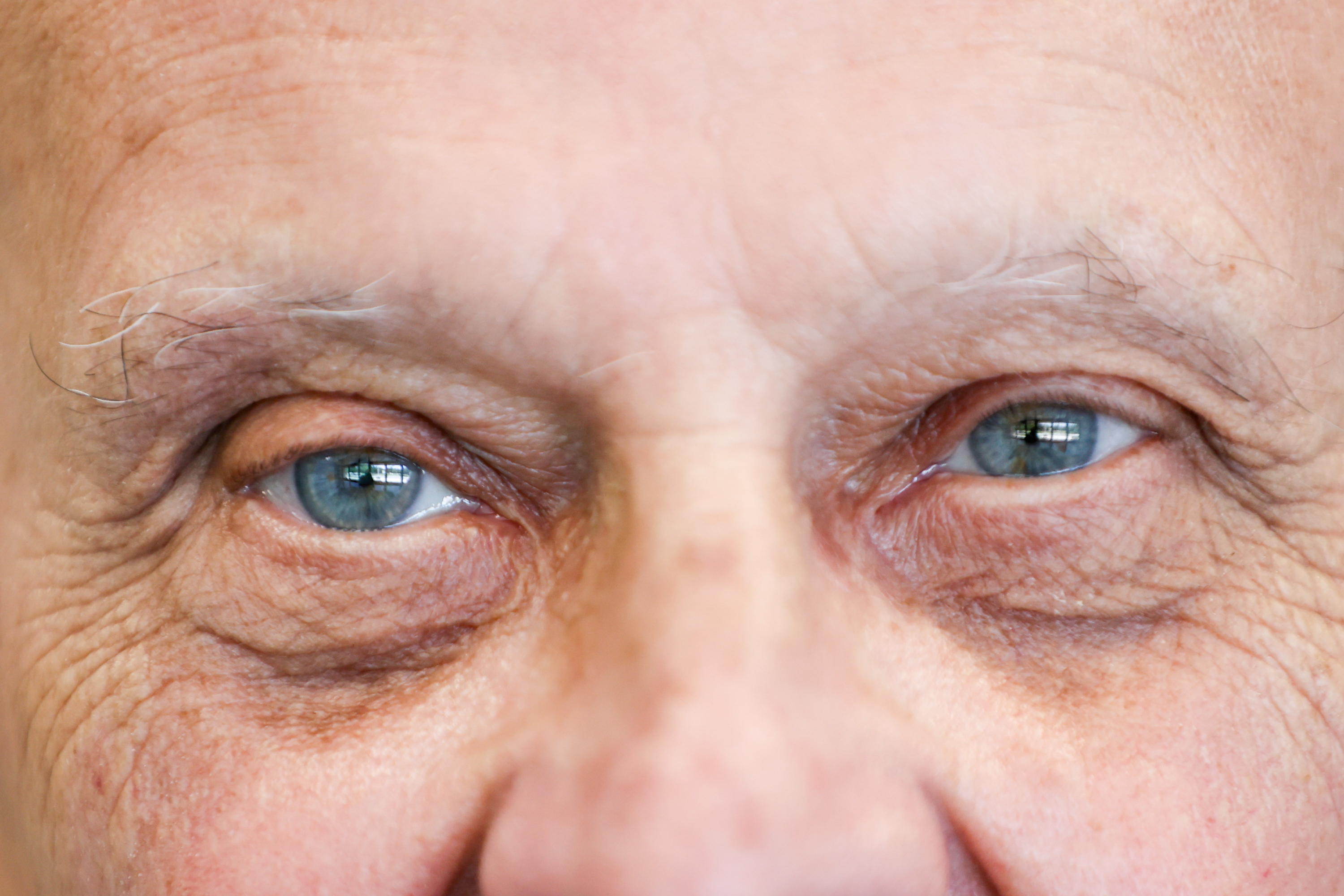 Why Do I See Wavy Lines In My Left Eye - Infoupdate.org