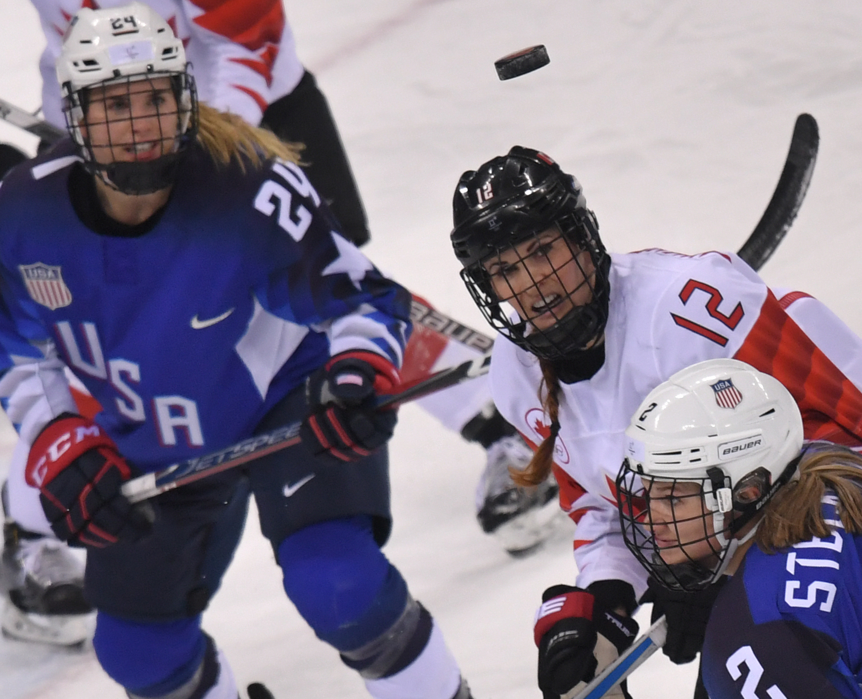 Meaghan Mikkelson Broken Hand